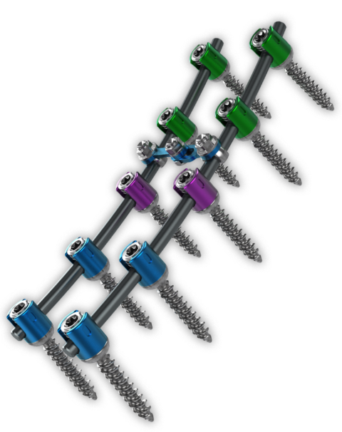 PROLIANT® Pedicle Screw System
