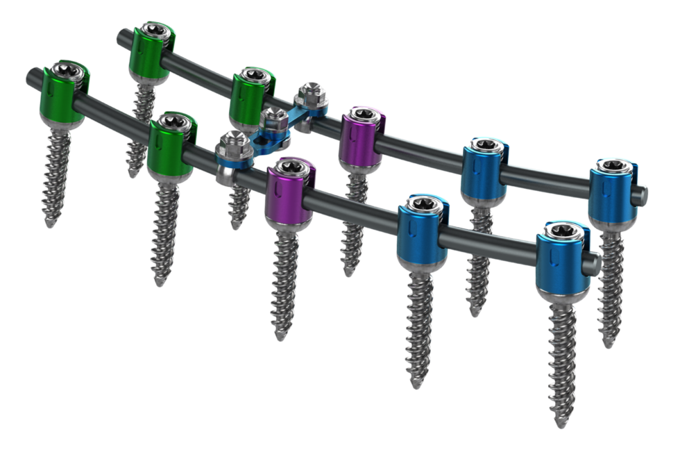 PROLIANT® Lumbar Pedicle Screw System | ChoiceSpine