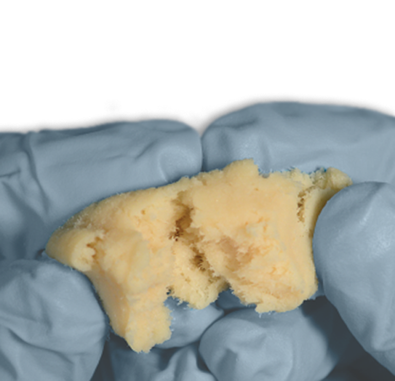 FIBER PUTTY | 100% Demineralized Bone Matrix